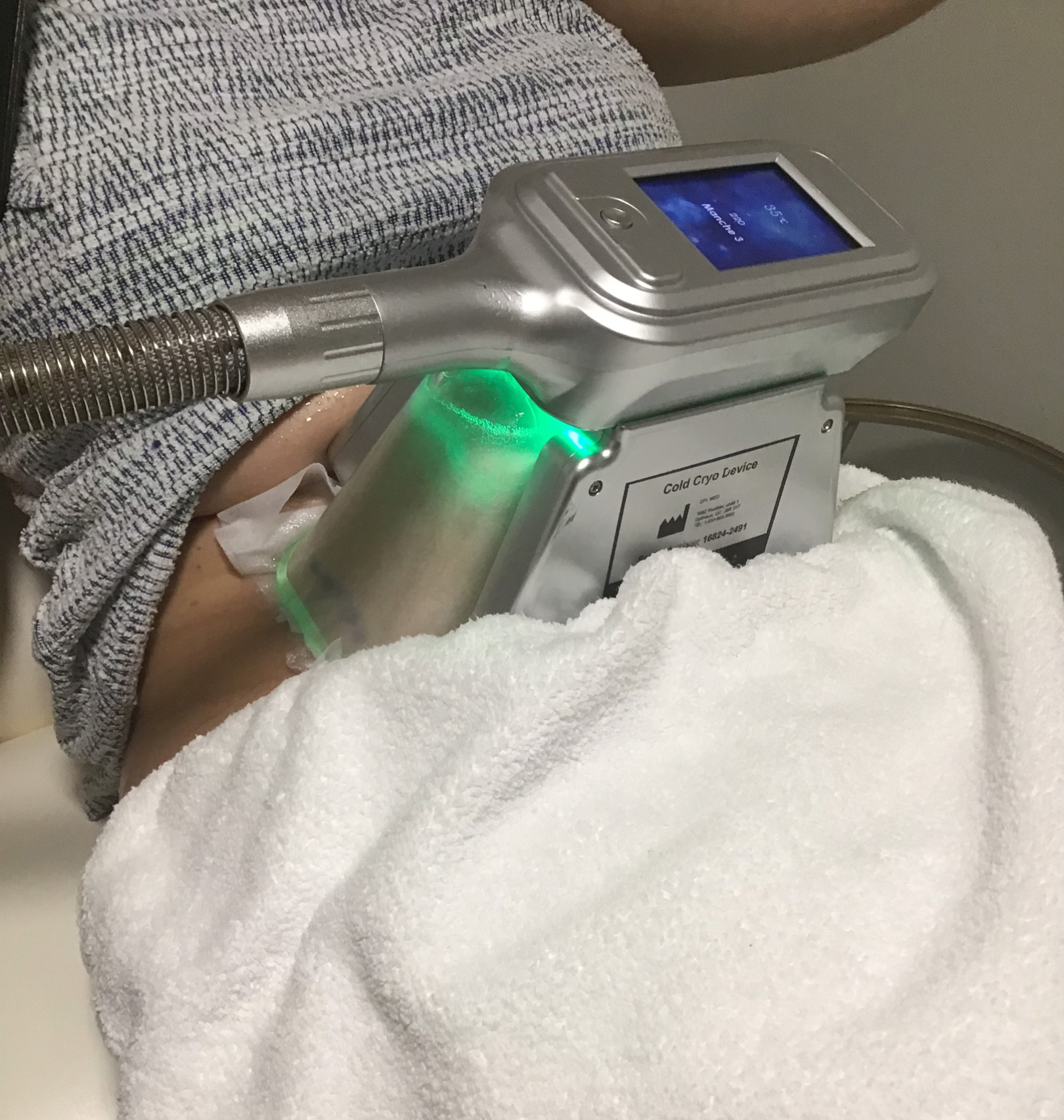 Cold Sculpting | Les Capricieuses